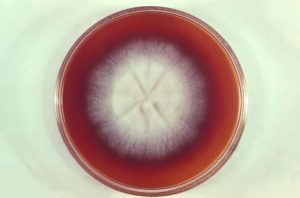 Favus in Chickens: Risks & Ringworm Treatment | Chicken Fans