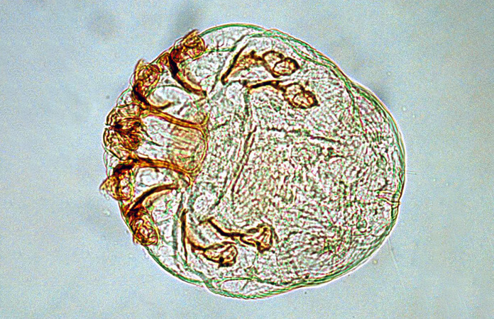 Scaly Leg Mites in Chickens - Symptoms & Treatment | Chicken Fans Scaly Leg Mites in Chickens - Symptoms & Treatment | Chicken Fans