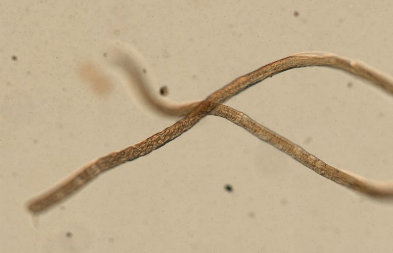 Worms in Chickens: How to Identify, Treat & Prevent Worms (2025 ...